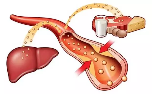 cholesterol. Cholesterolgehalte in voedsel. Producten die het cholesterolgehalte in het bloed verlagen.